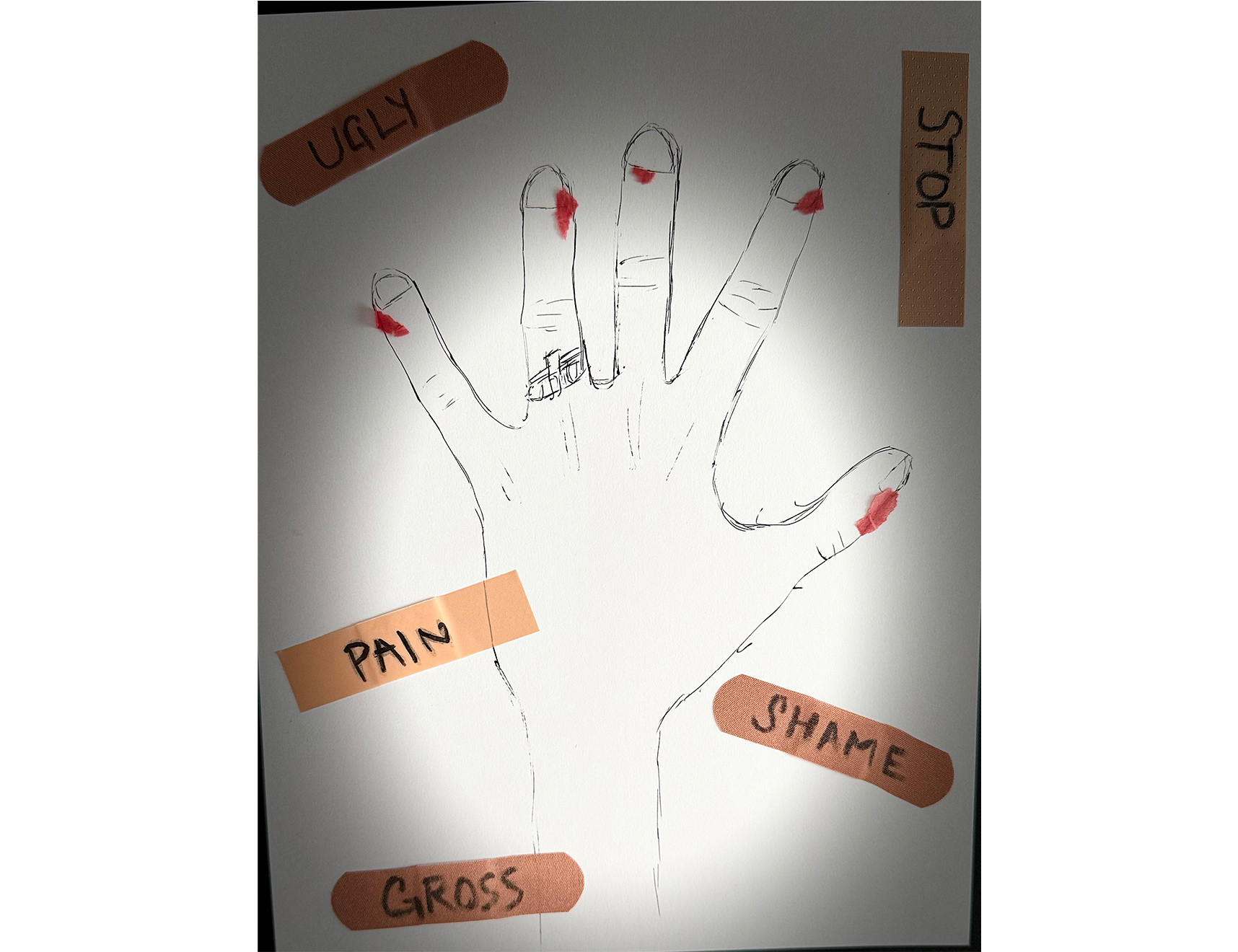 Skin Picking / Dermatillomania Art by Suffers and Supporters of the ...