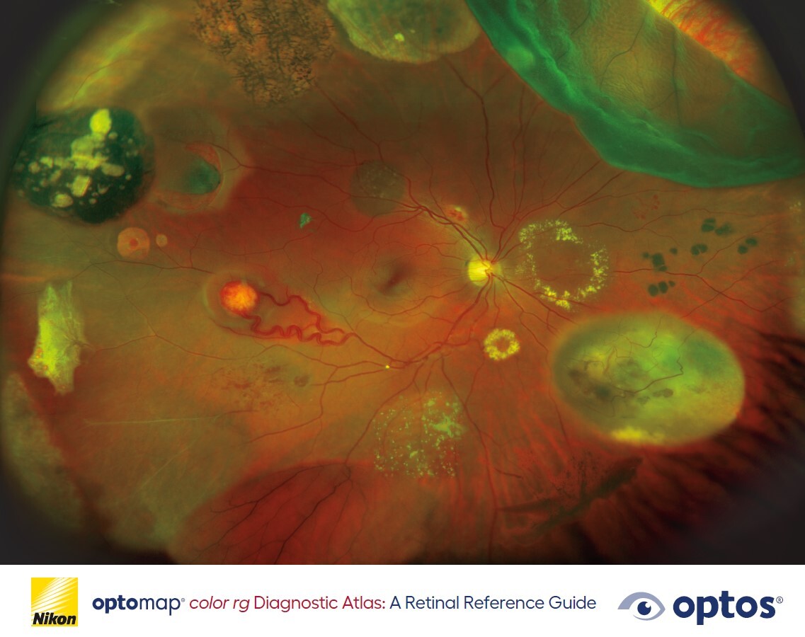 optos Items : optos : Curry Printing