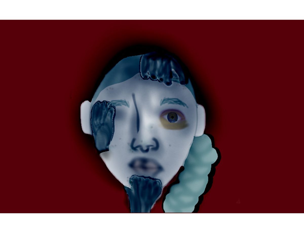 Skin Picking / Dermatillomania Art by Suffers and Supporters of the ...