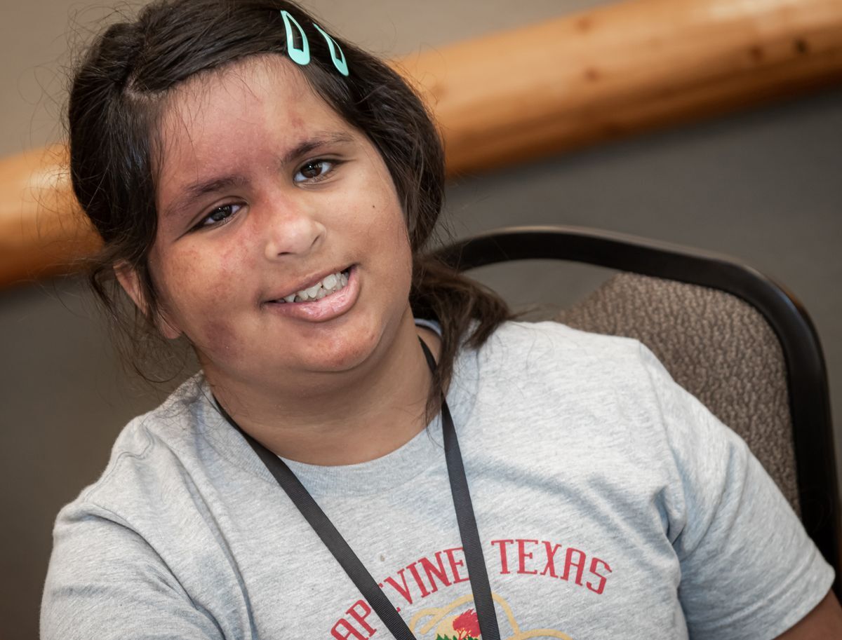 Types of The Sturge-Weber Syndrome