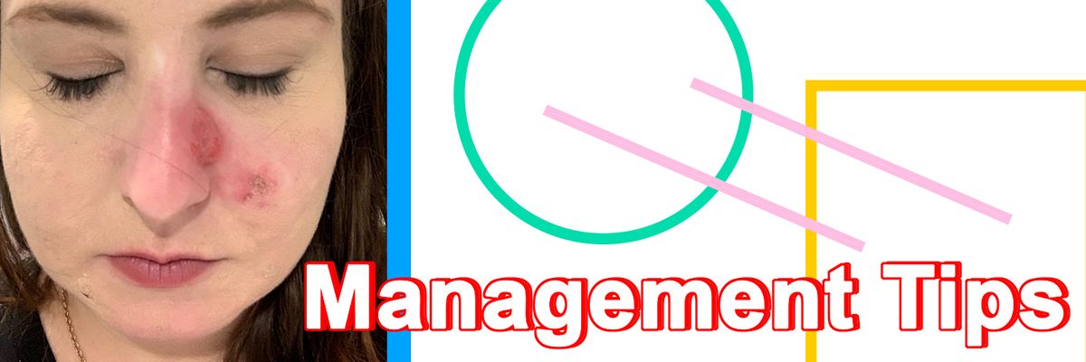 Management Tips for Skin Picking Disorder