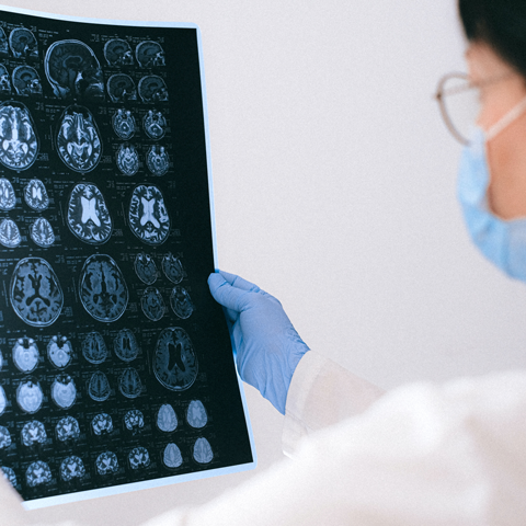 Questions for the Neurologist