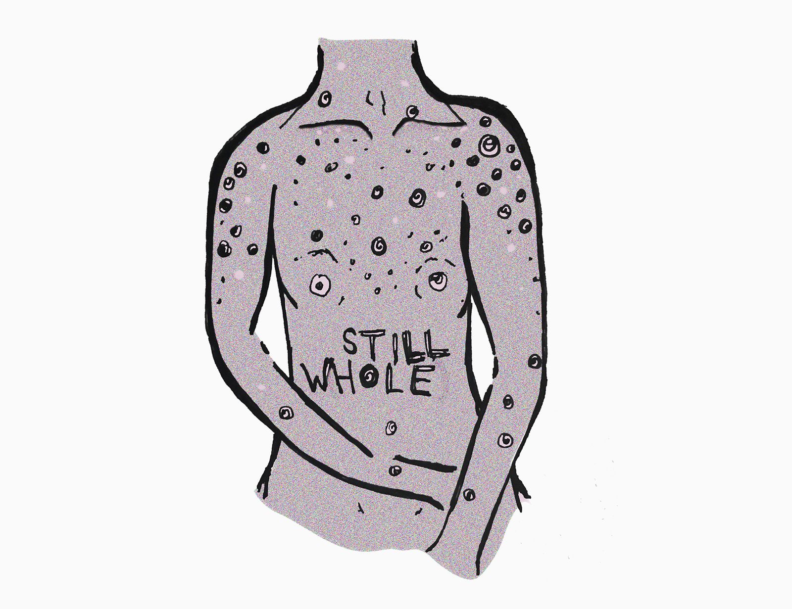 Skin Picking / Dermatillomania Art by Suffers and Supporters of the ...