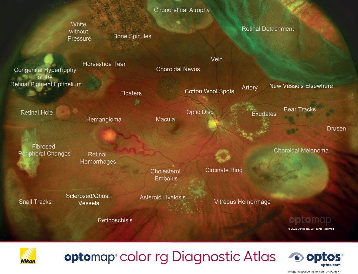 optos Items : optos : Curry Printing