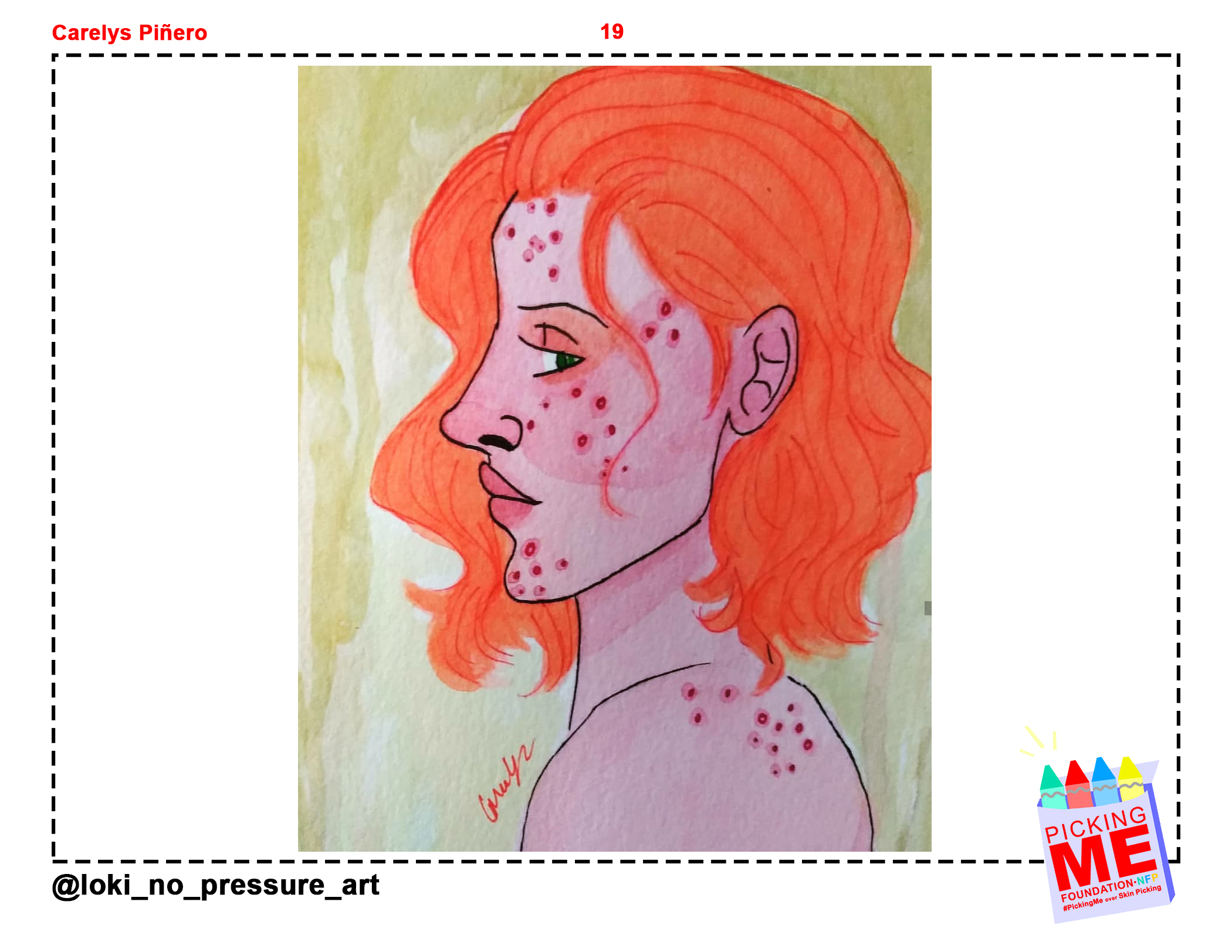 Skin Picking / Dermatillomania Art by Suffers and Supporters of the ...