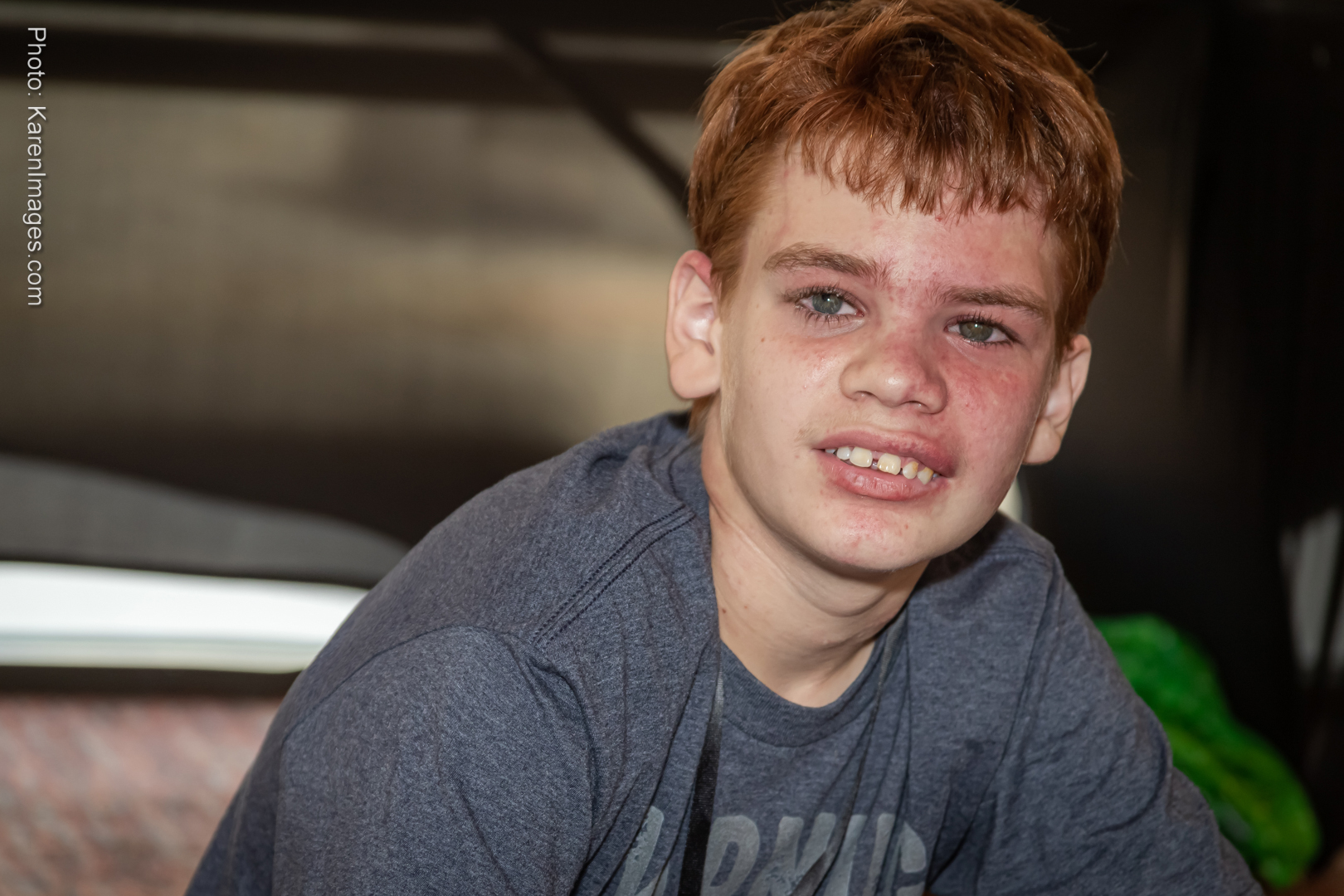 The Sturge-Weber Foundation Inspirational Stories