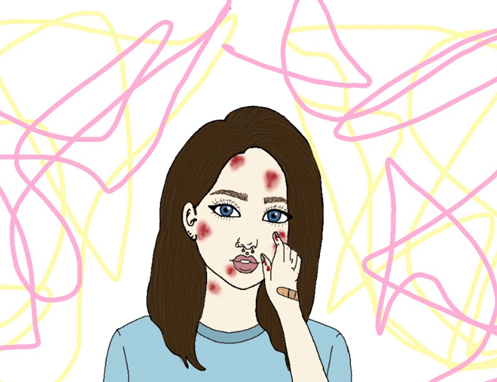 Skin Picking / Dermatillomania Art by Suffers and Supporters of the ...