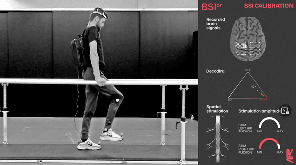 Headline Patrol: Paralyzed Man Walks with Brain Implants